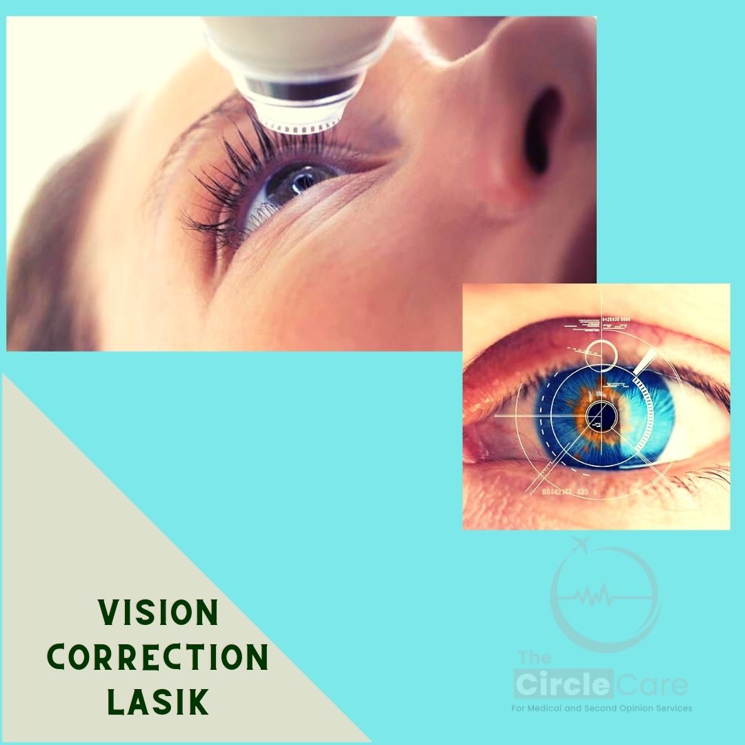 Vision Correction custom LASIK – تحسين الرؤية بالليزر المخصص – The ...